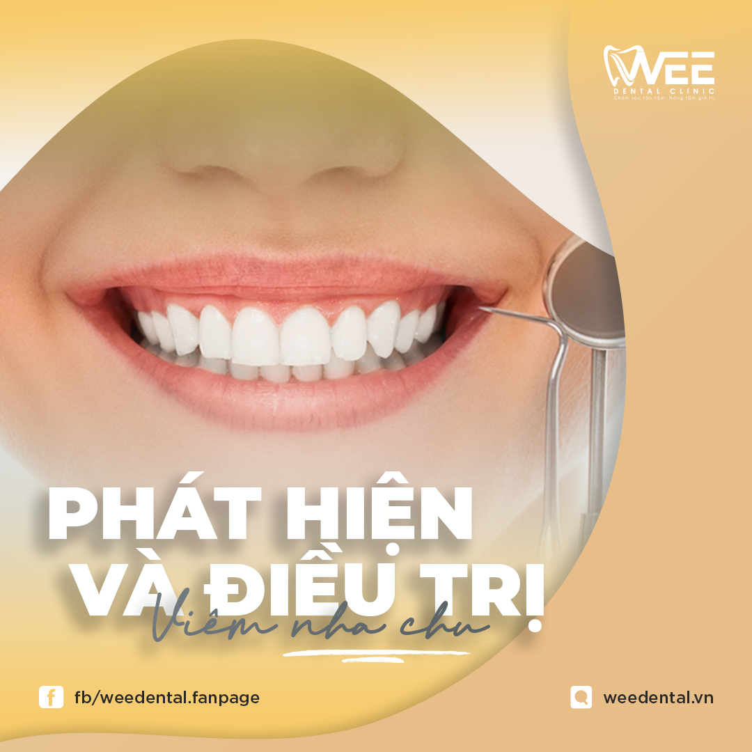 ĐIỀU TRỊ VIÊM NHA CHU KỊP THỜI TRÁNH BIẾN CHỨNG NGUY HIỂM - Wee Dental 2026